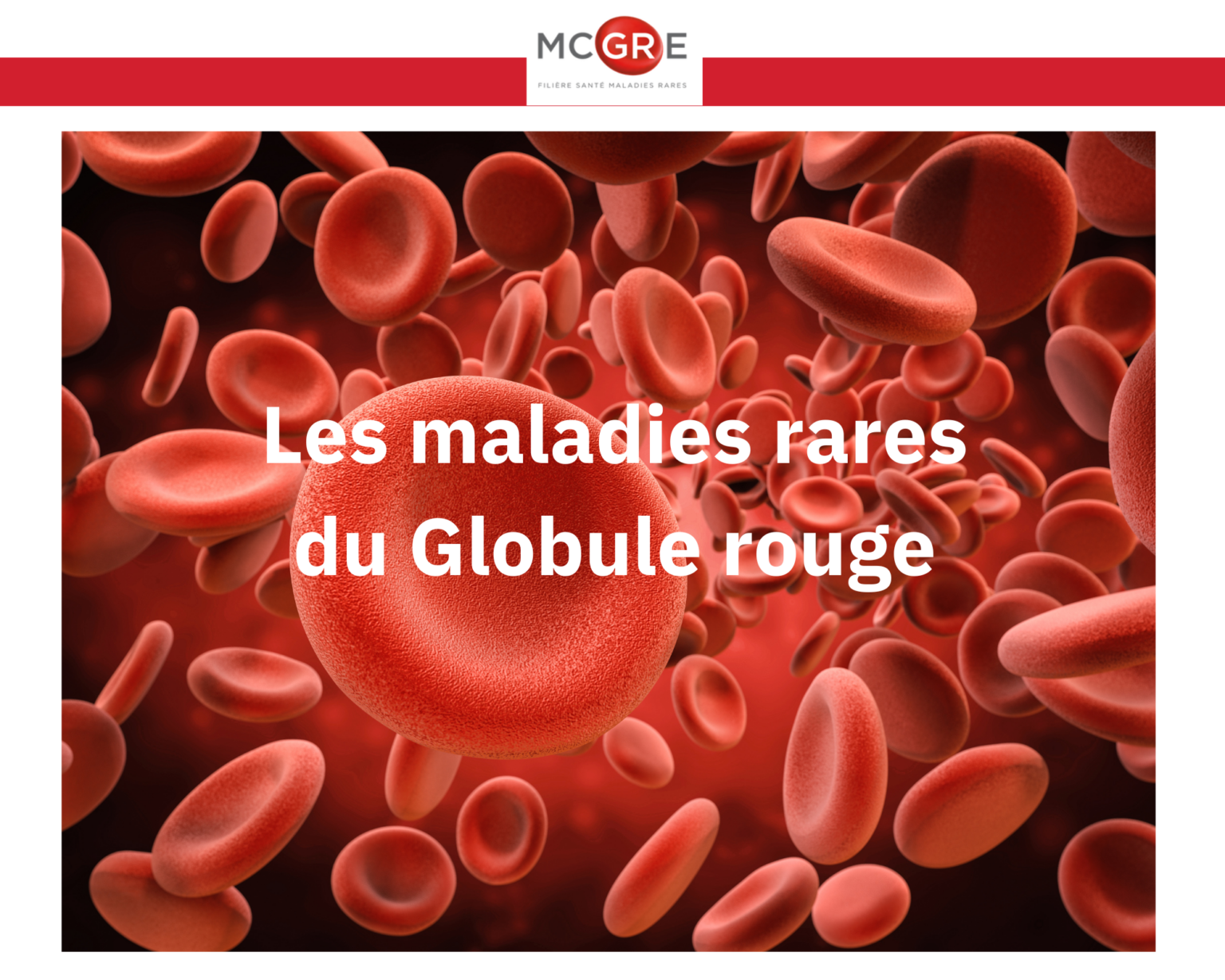 Les maladies rares du globule rouge - MCGRE - Filière de santé maladies ...